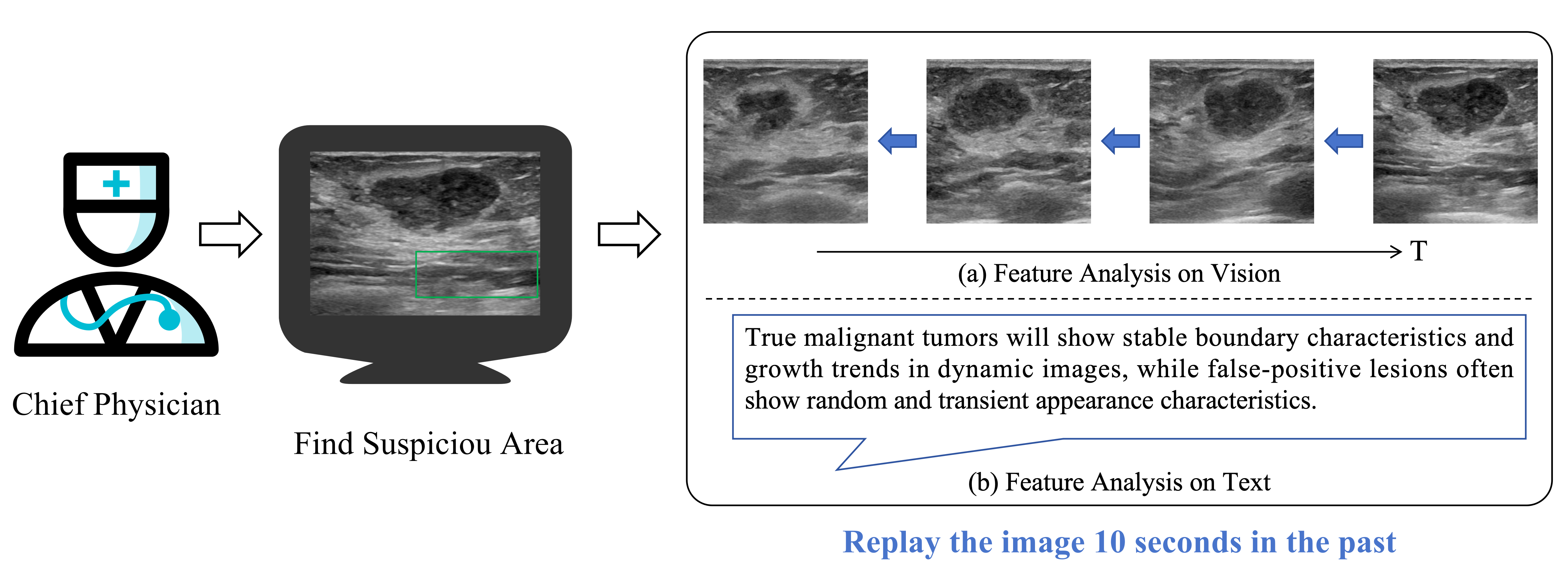 Technovation Girl Breast Cancer Detection Project