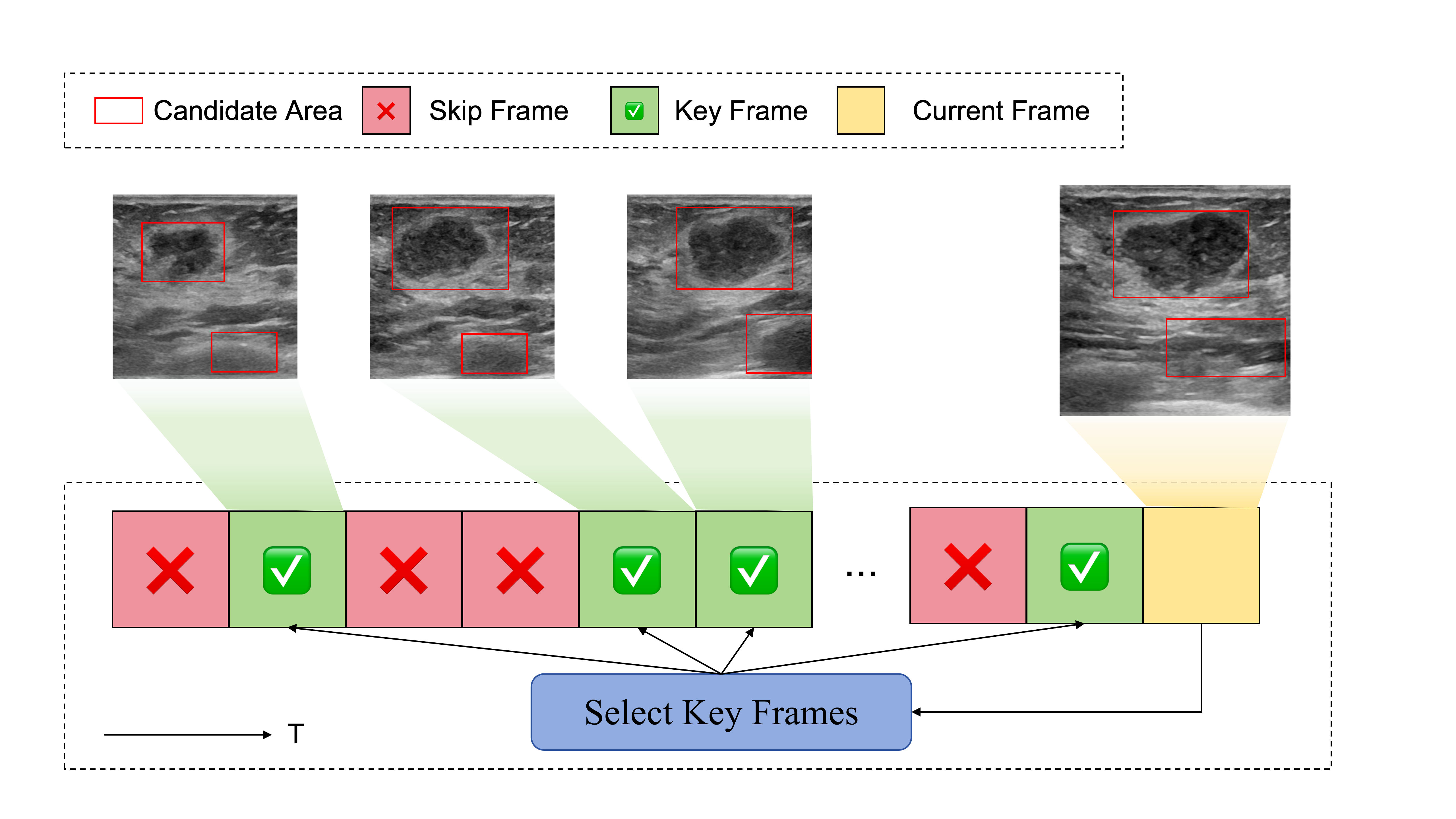 Technovation Girl Breast Cancer Detection Project