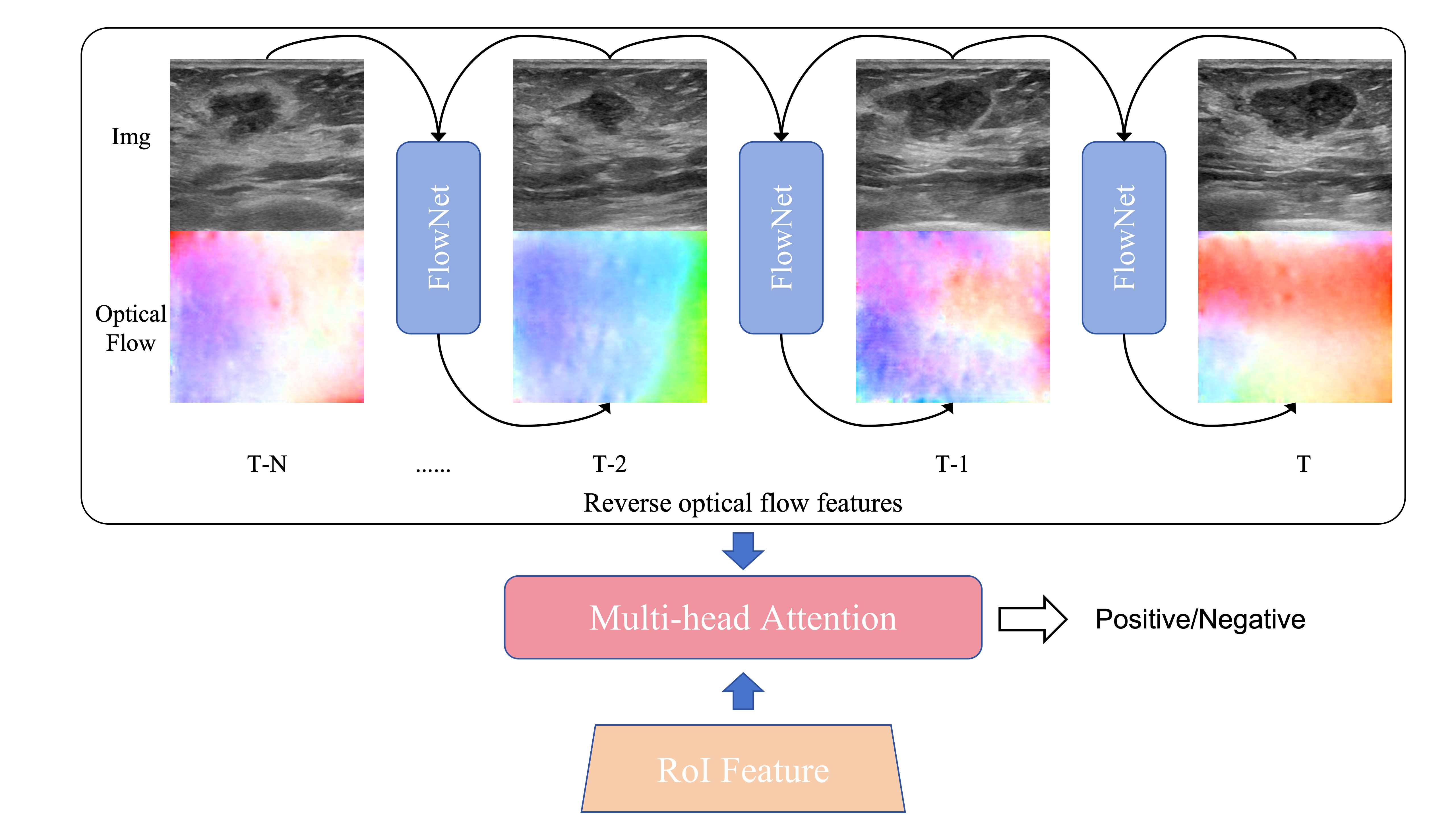 Technovation Girl Breast Cancer Detection Project